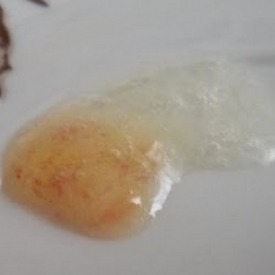 Balgam lar - YouTube