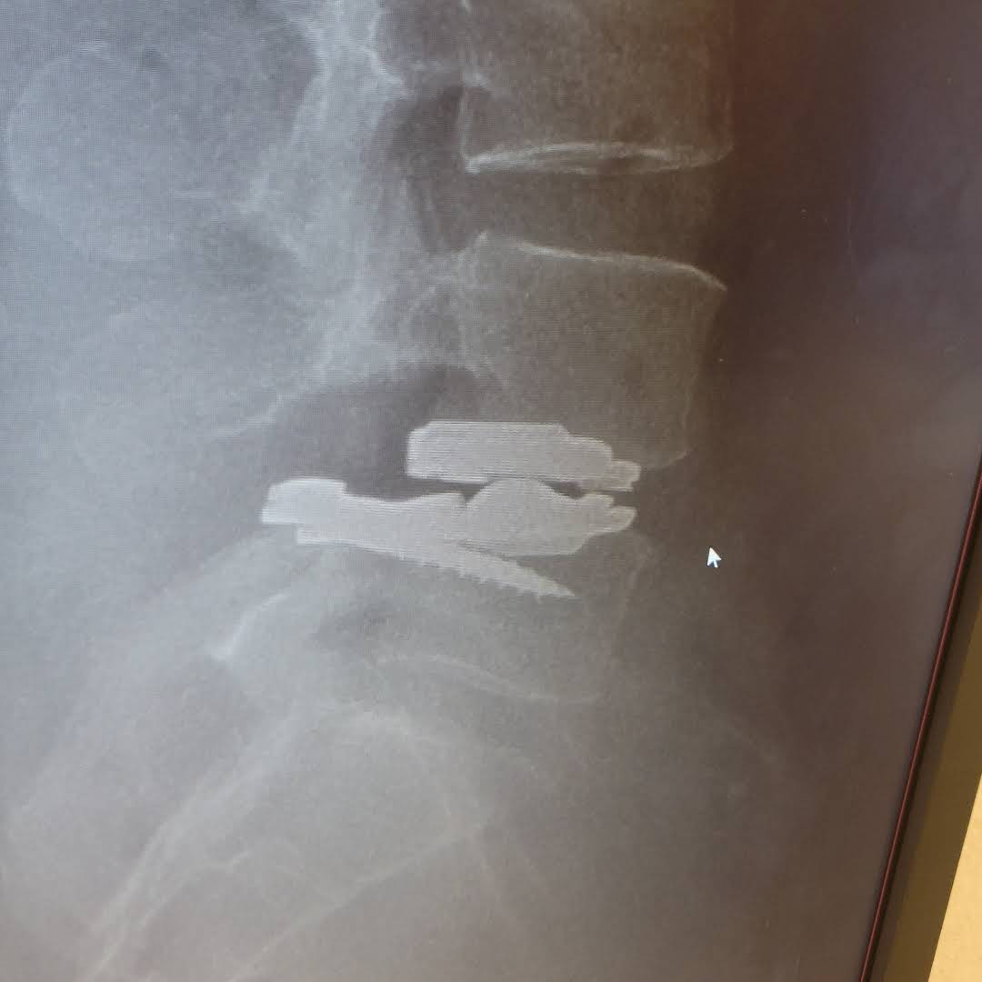 Post from DLM tech garage