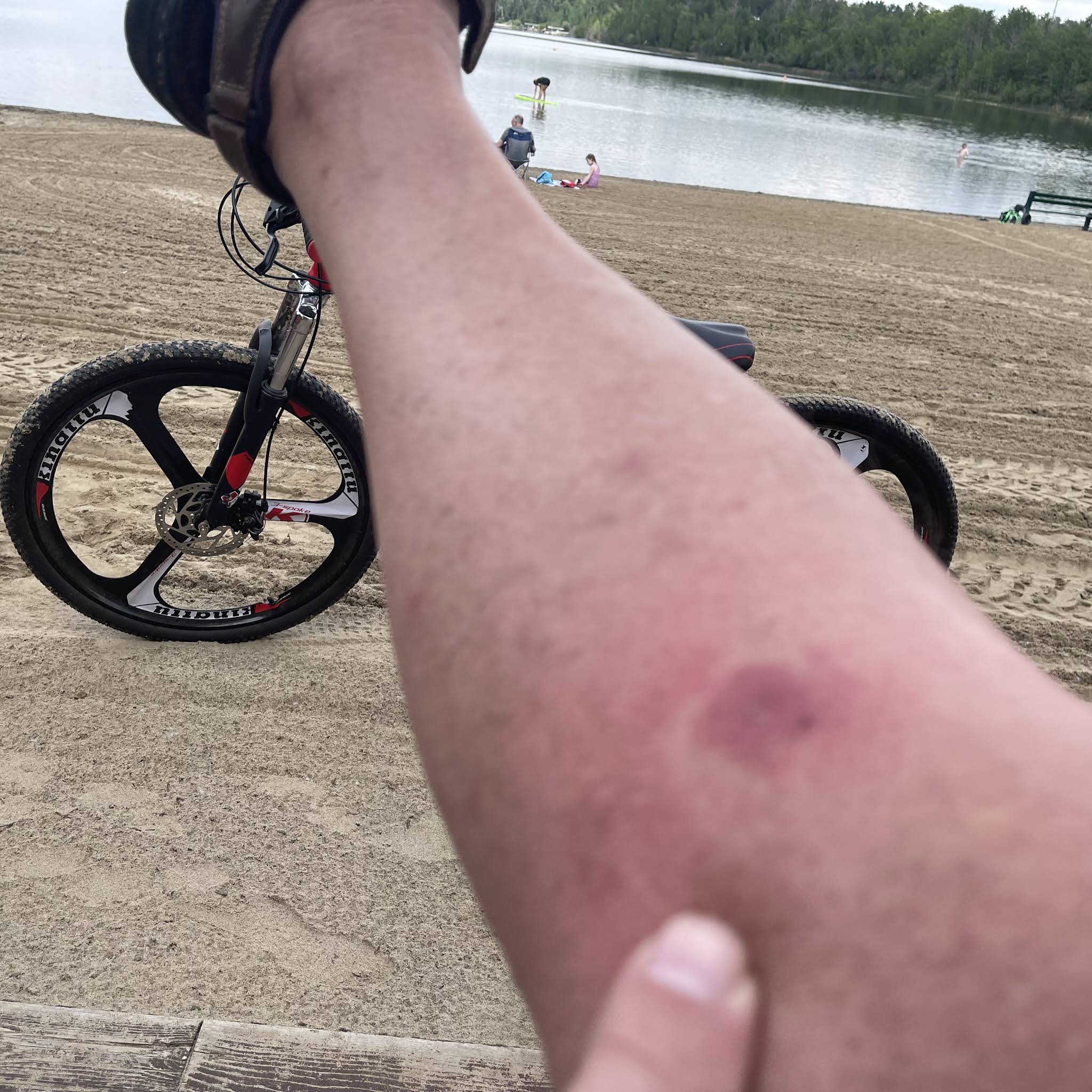 Post from Tommy Temper