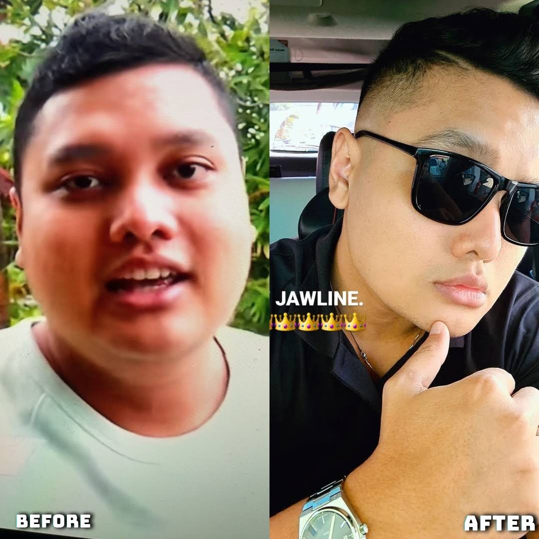 Post from Laurent Rando