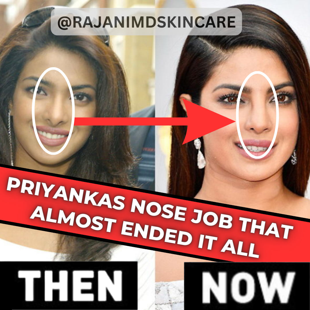 Post from Dr. Anil Rajani