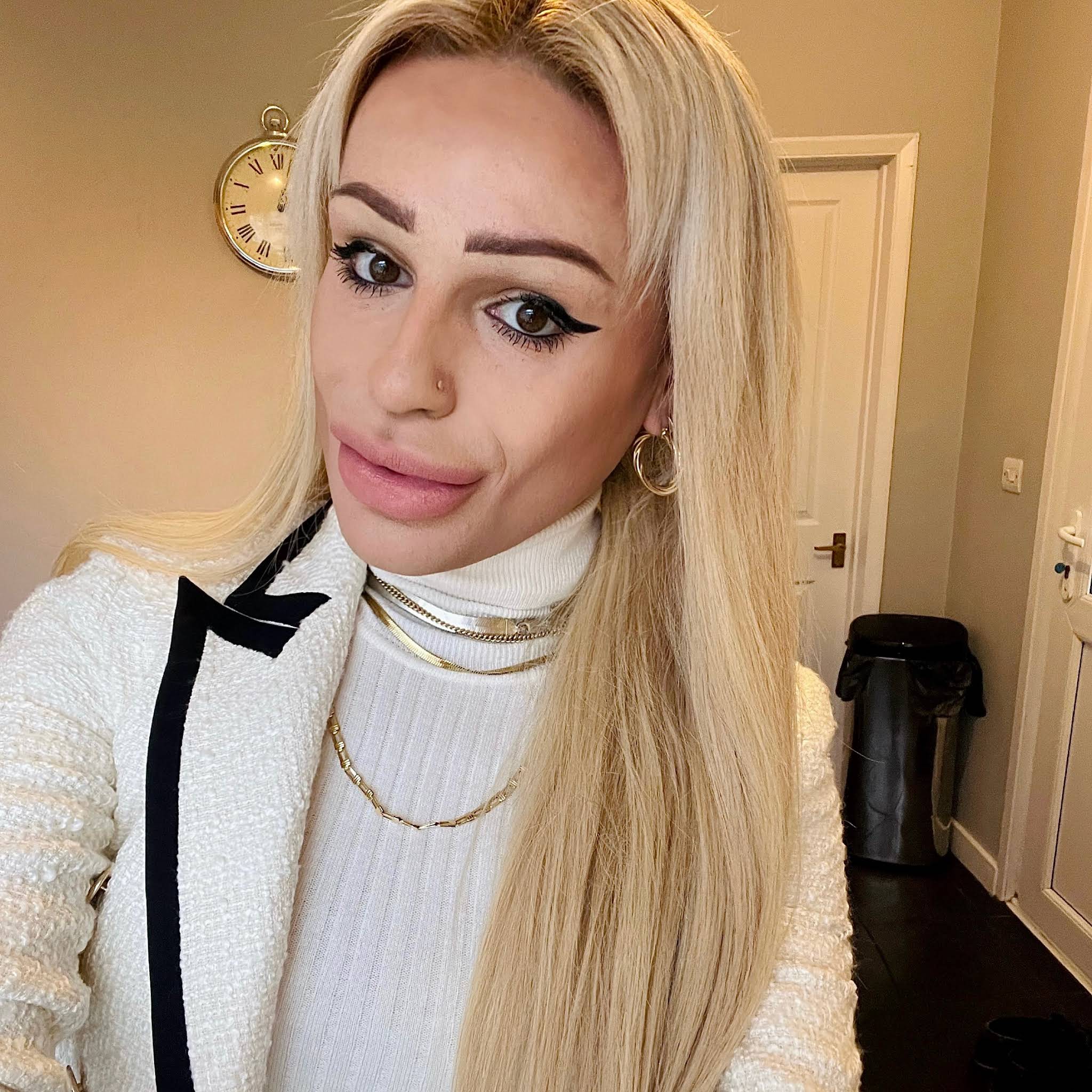 Post from FABS MATTISON