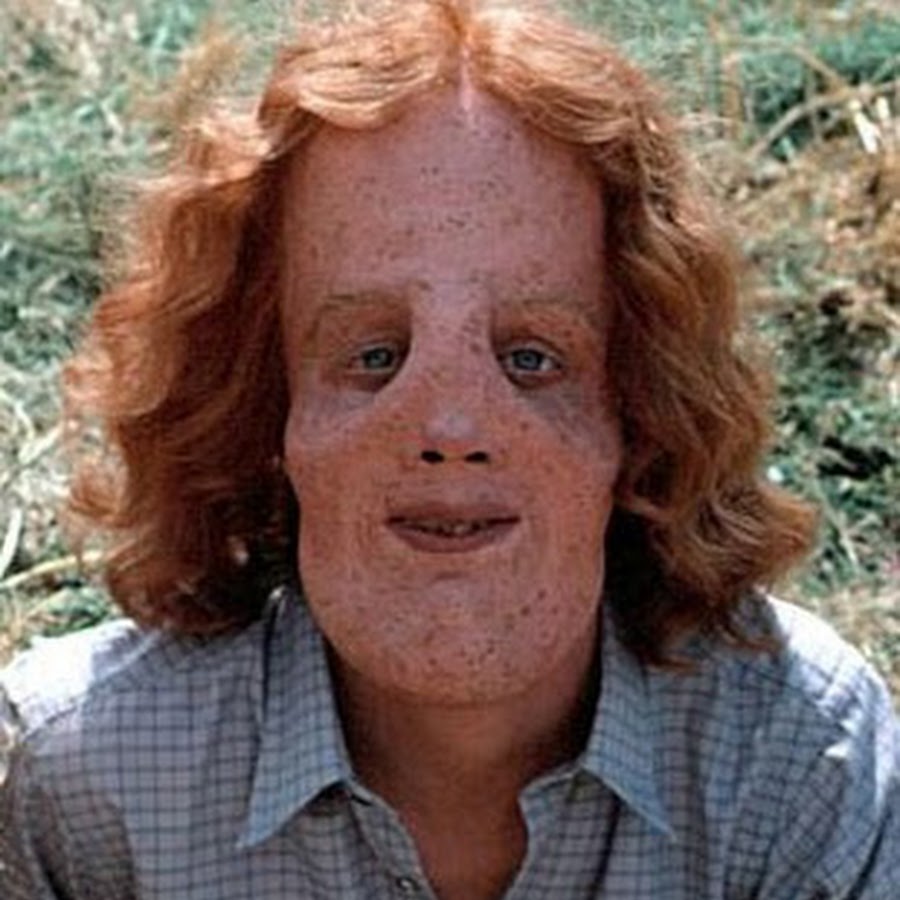 Big Rocky Dennis - YouTube