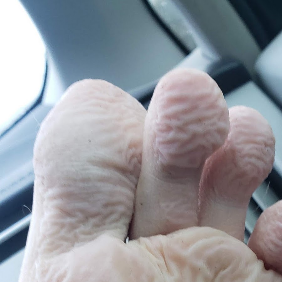 crusty toe - YouTube