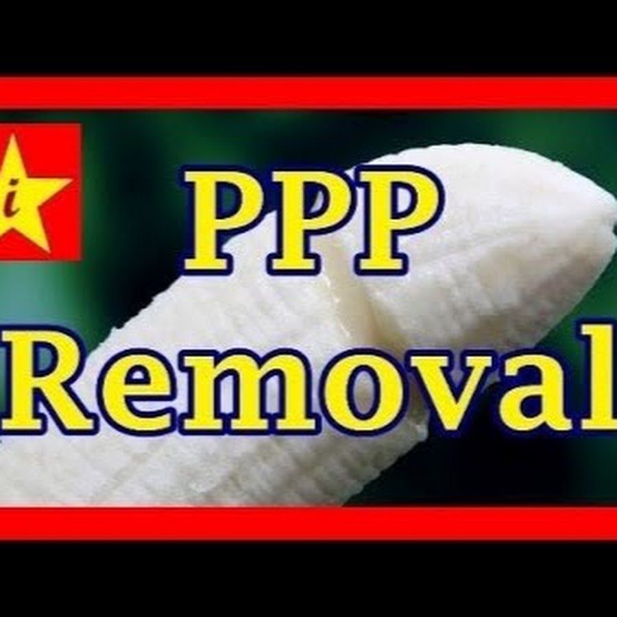 Pearly Penile Papules Removal - YouTube