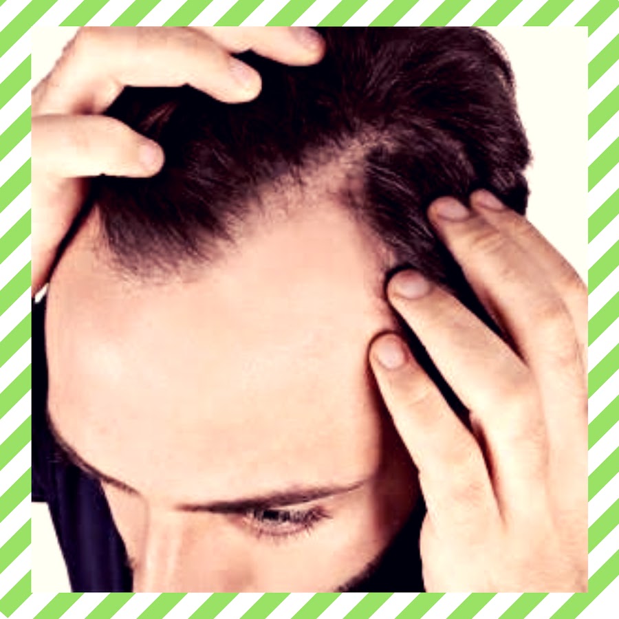 Guia Como Acabar com a Calvicie Funciona? - YouTube