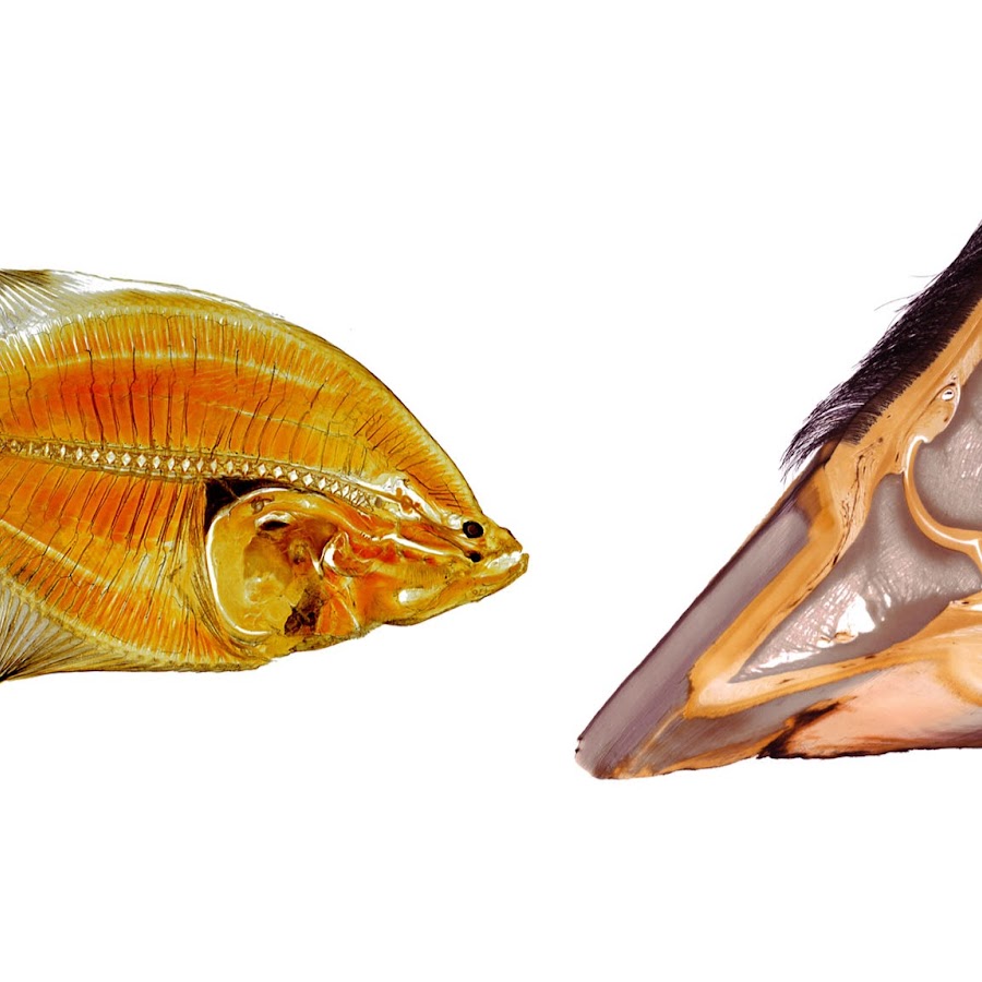 Plastination and real anatomy - YouTube