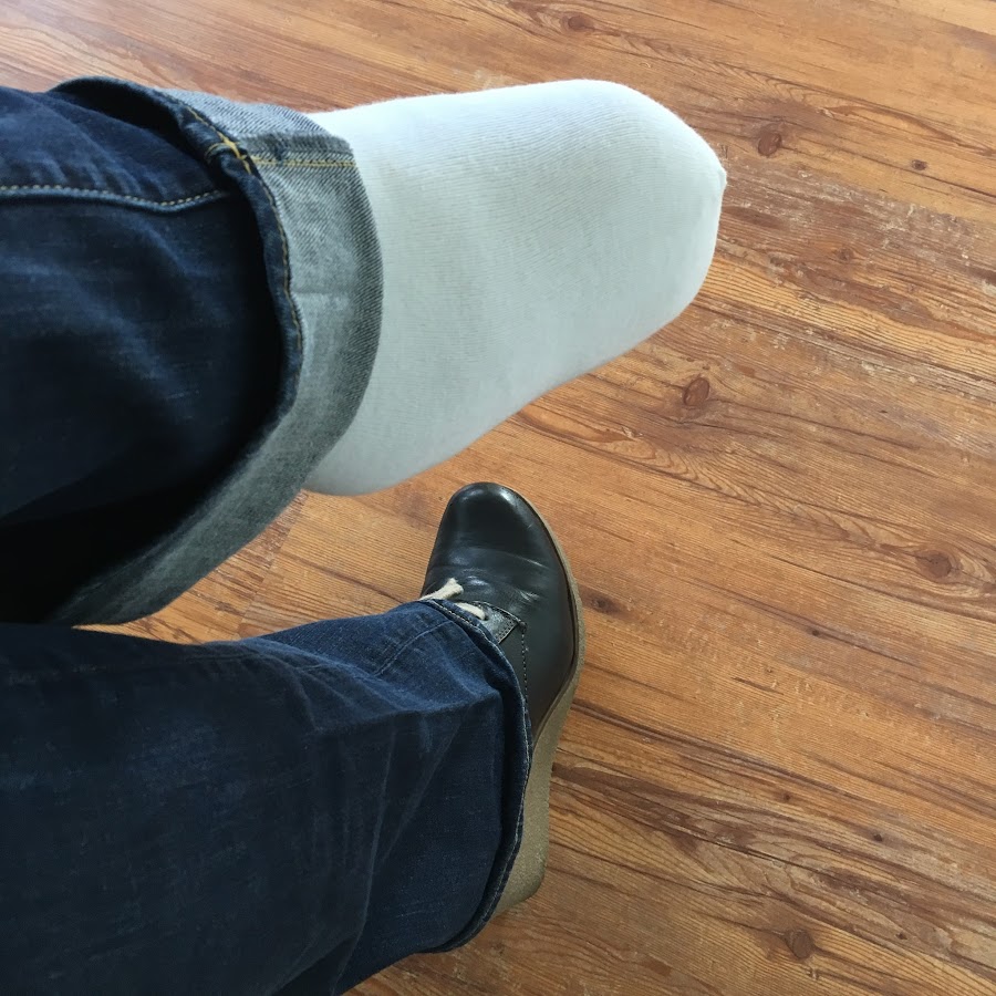 Crippled Foot - YouTube