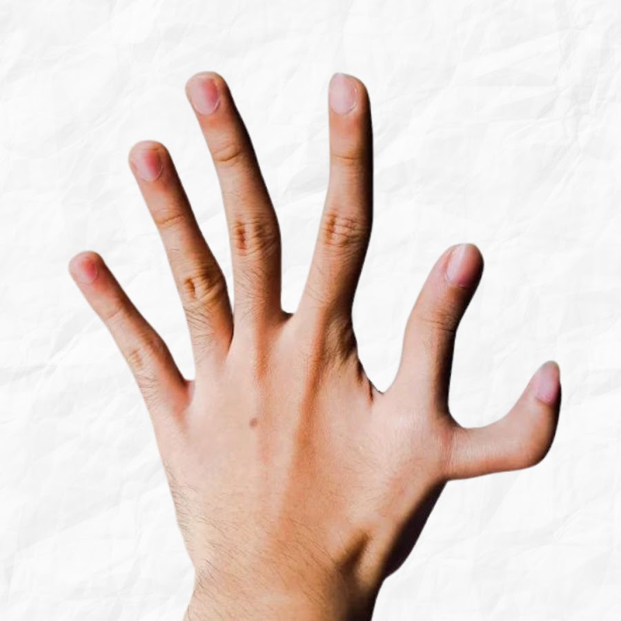 Mr.Sixth Finger - YouTube