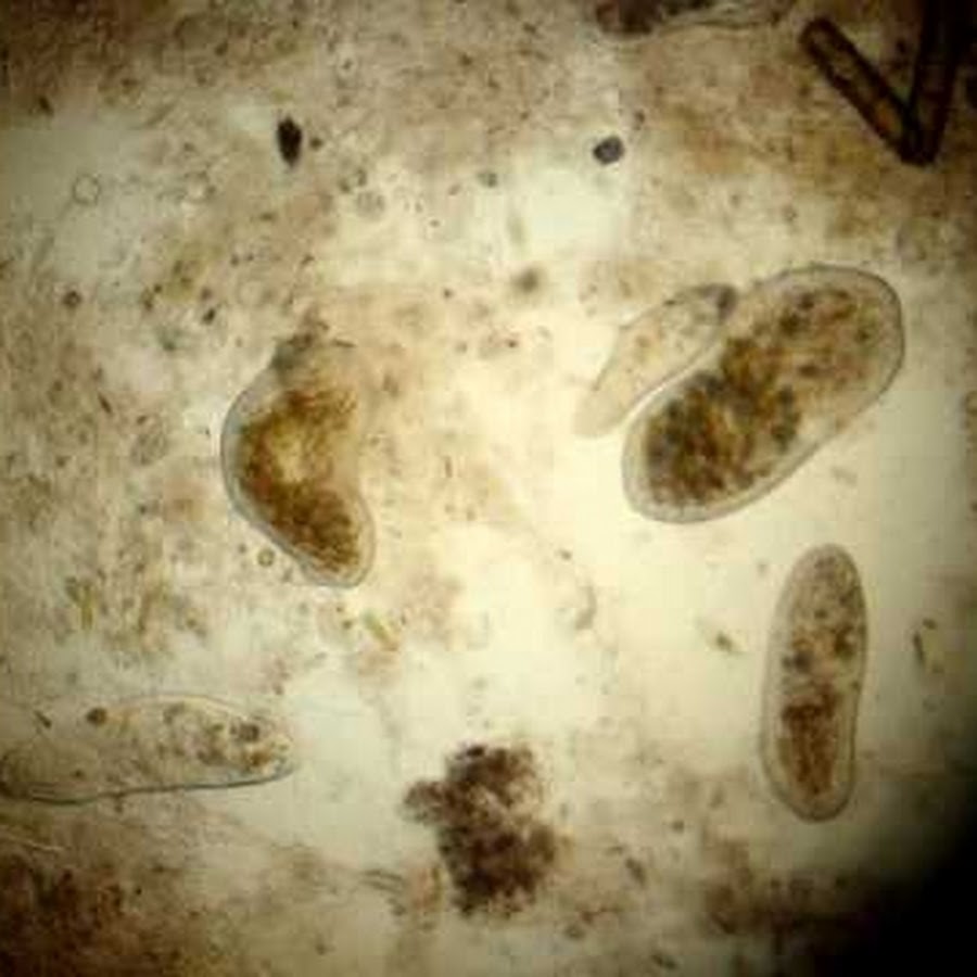 protoctistas - YouTube