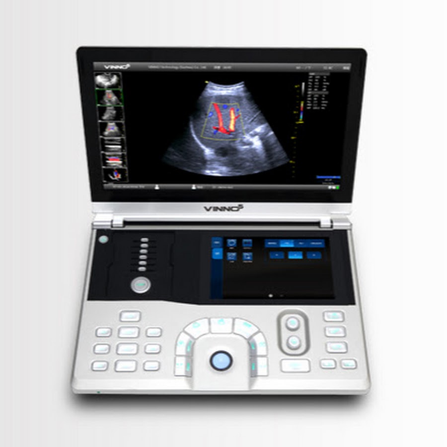 Real Time Ultrasound Machines - YouTube