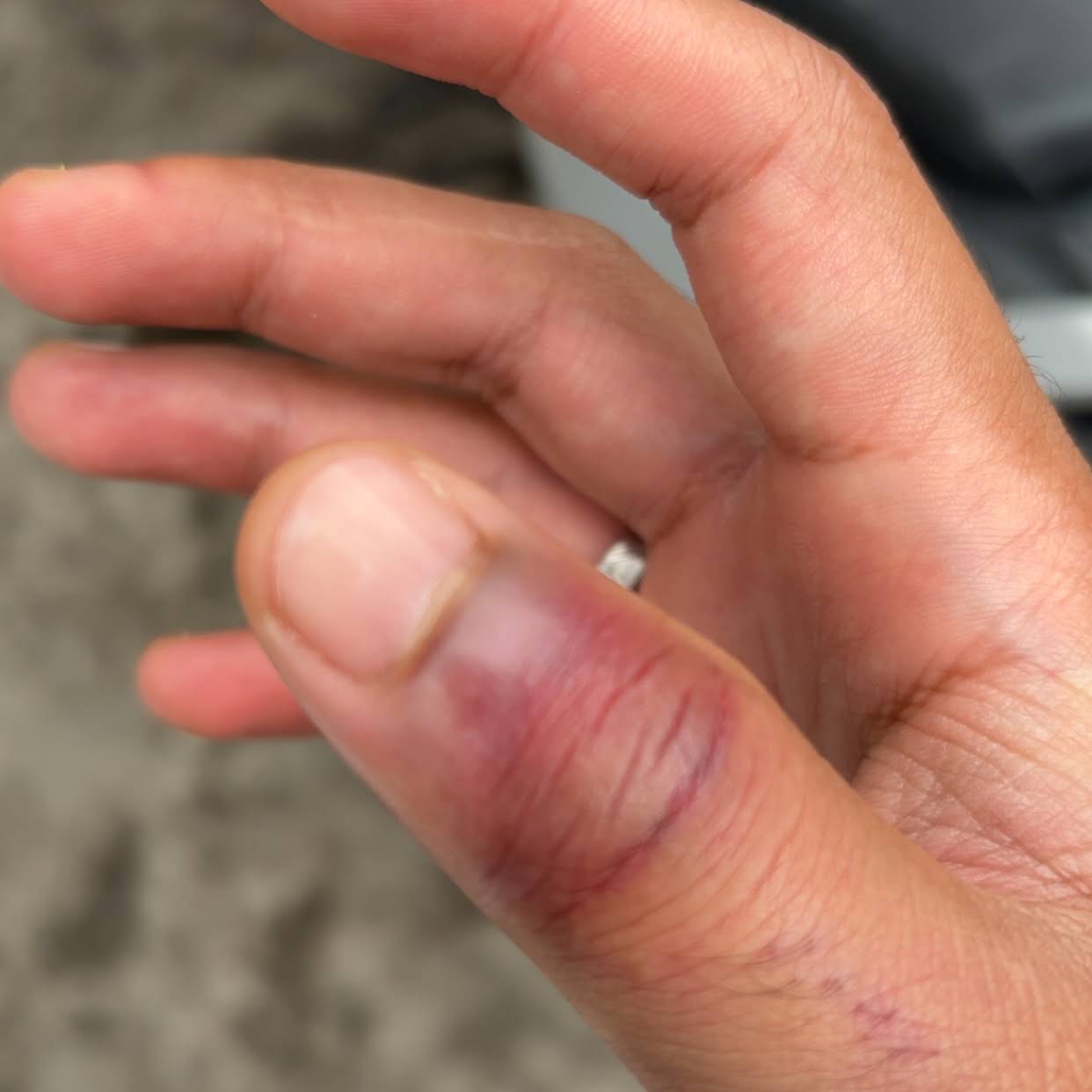 Post from Carnage CODM