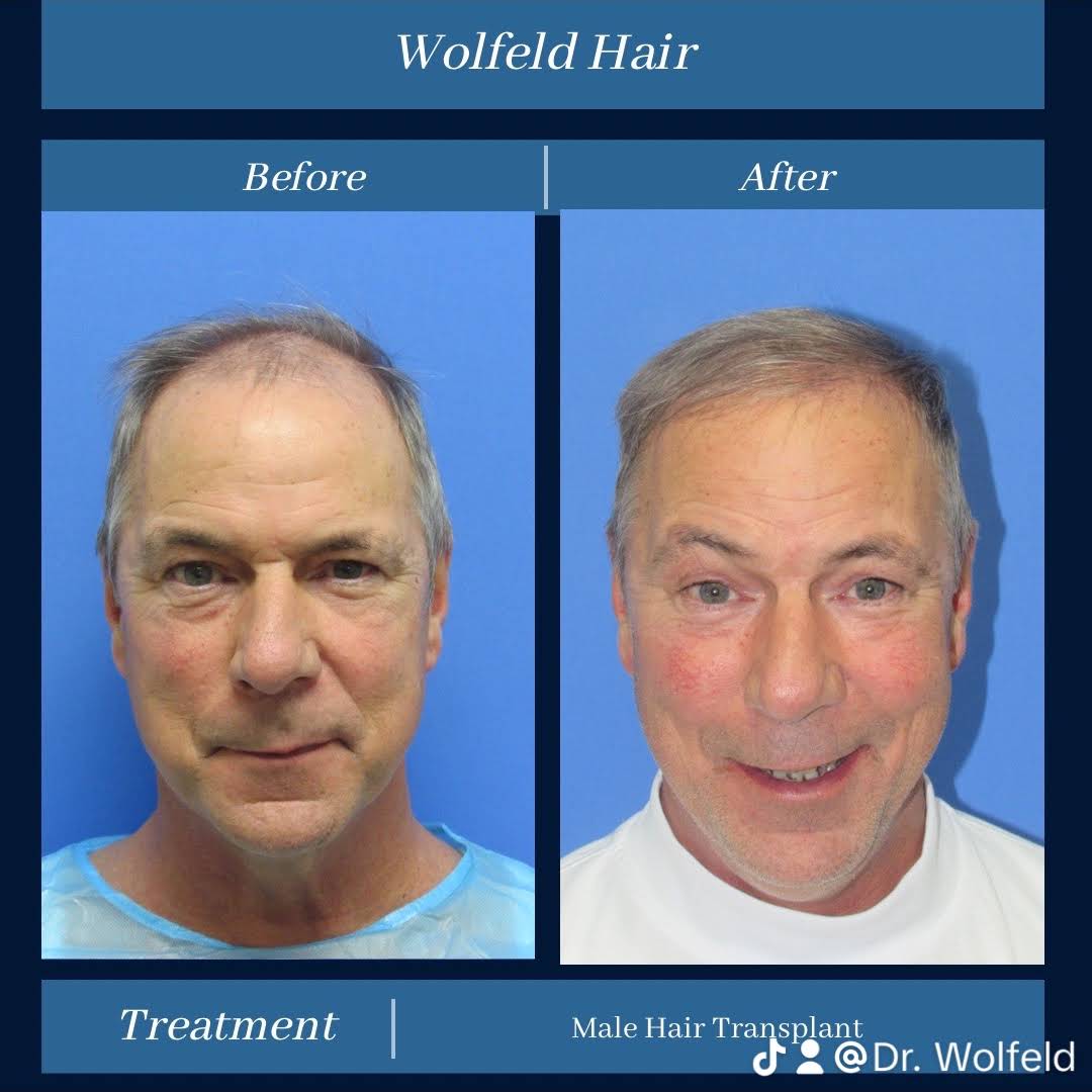 Post from Wolfeld Hair