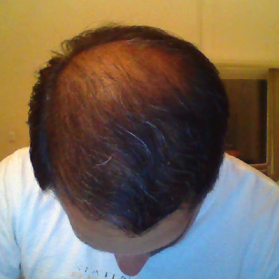 AMLnZu-tVv5hV20tZiySfl4RqBaz7tMvNC-hanZRdVyGGQ=s900-c-k-c0x00ffffff-no-rj